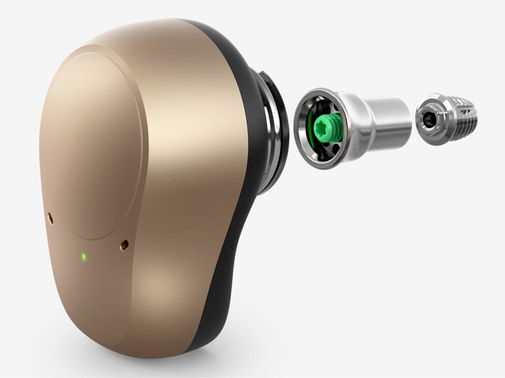 Prothèse auditive à ancrage osseux