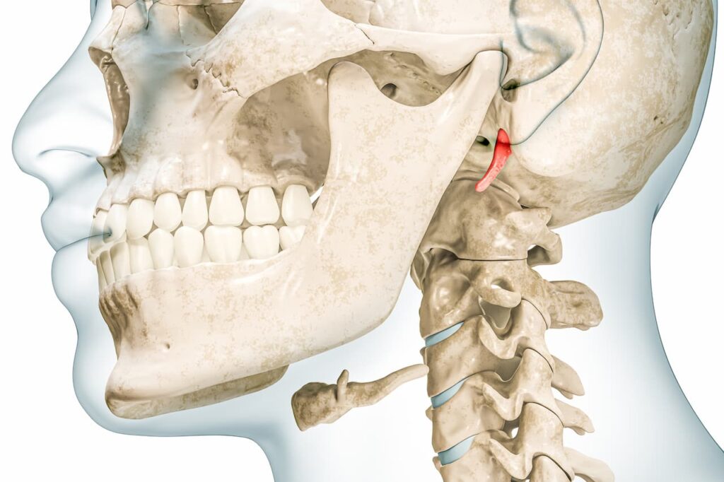 Syndrome stylo hyoïdien ou syndrome d'Eagle | Ablation de la portion ...